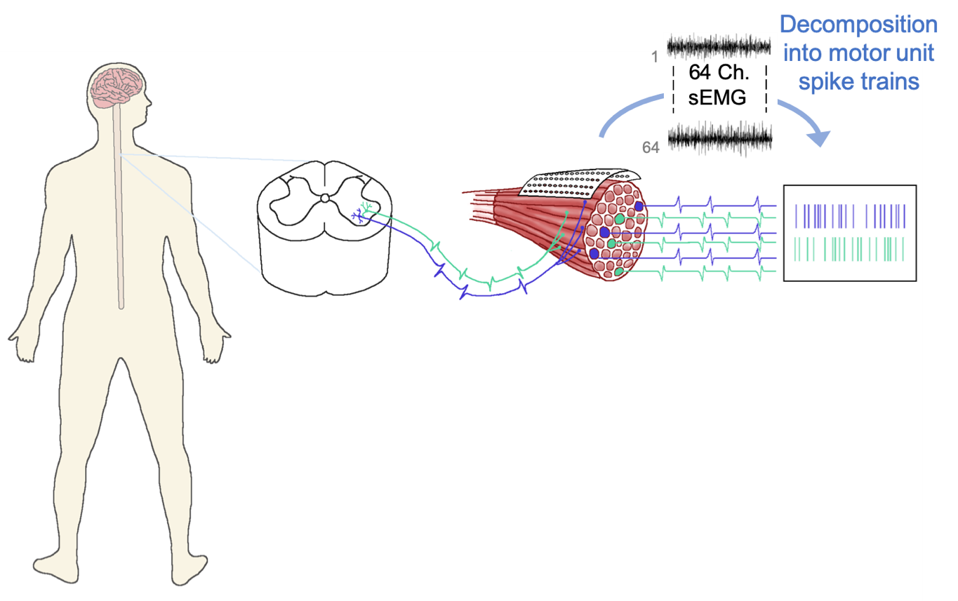 Neural Control of Movement Following Neurological Injury - Program in ...