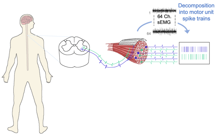 Neural Control of Movement Following Neurological Injury - Program in ...